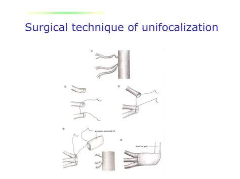 Ppt Surgical Treatment Of Pa With Vsd Withoutwith Mapca Powerpoint Presentation Id5132735