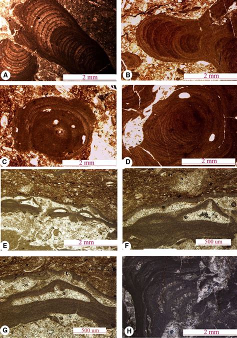 Photomicrographs Of Some Coralline Red Algae That Recognized In