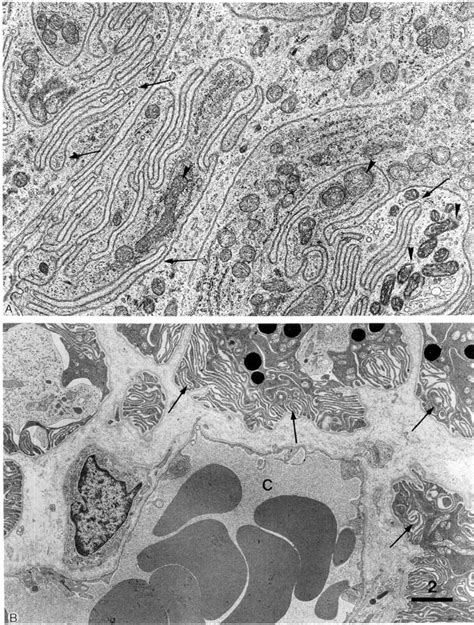 Electron Microscopy Of The Ciliary Epithelium In The Apical Part Of The