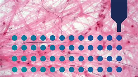 Autoimmune Testing Applications — Bio Rad