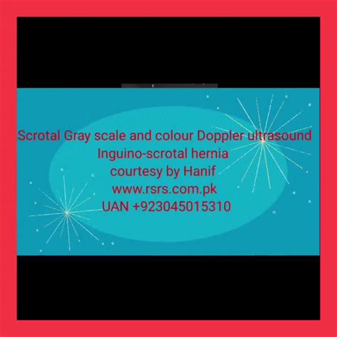 Rabbani School Of Radiology And Sonology Rsrs On Linkedin Hello 👋