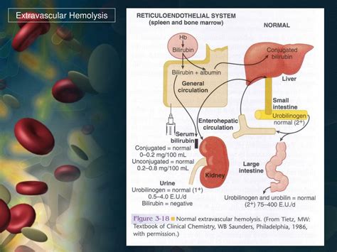 Ppt Red Blood Cell Disorders Powerpoint Presentation Free Download