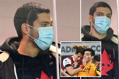 Raul Jimenez Shows Off Shocking Head Scar In Wolves Stands Vs Everton