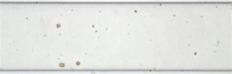 Algae Object Detection Dataset By Algaeibegyou