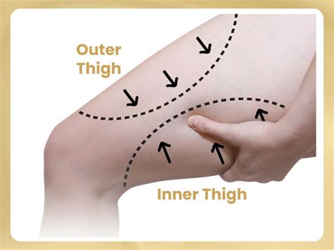 Thigh Liposuction In Singapore Thigh Fat Removal