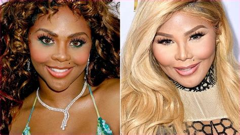 Kim Plastic Surgery Before And After