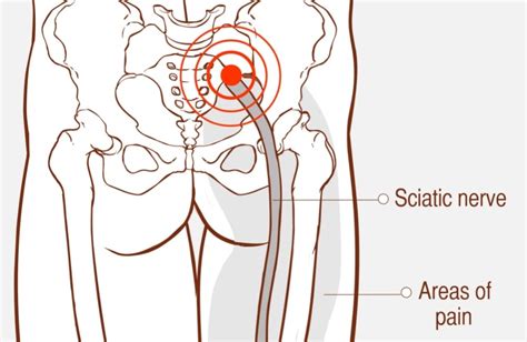 5 Effective Stretches To Relieve Sciatic Hip Lower Back And Leg Pain