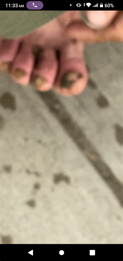 Just A Gallery Of Daniels Trench Foot Enjoy 😊 R Daniellarson