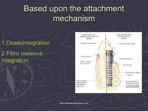 Classification And Impression Techniques Of Implants Dentistry Dental