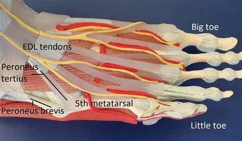5th Metatarsal Fracture Dr Ben Beamond Adelaide