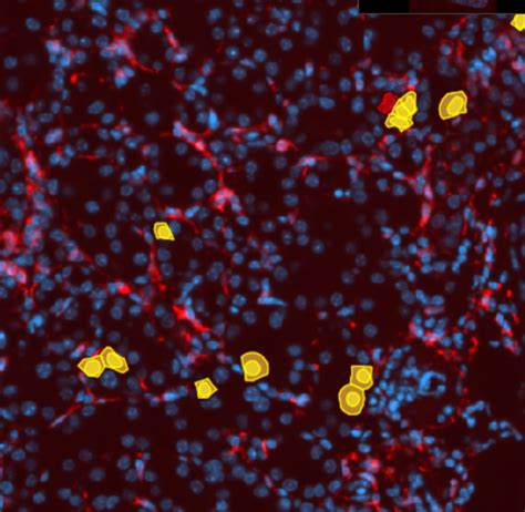 Exporting Measurements For Specific Classes Of Detections Only In Batch Image Analysis