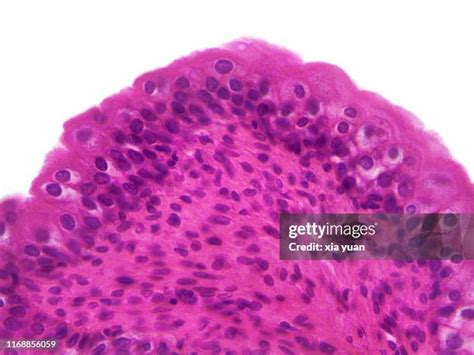 Transitional Epithelium Photos And Premium High Res Pictures Getty Images