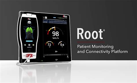 Masimo Rootとは マシモ ルート Masimo Rootとはの動画 Lgjozg