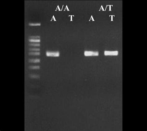 The Detection Of Single Nucleotide Polymorphisms Genotype Distribution Download Scientific