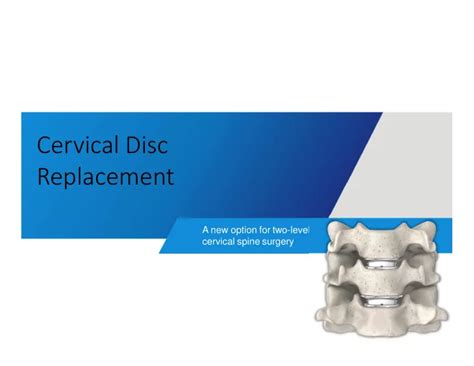 Ppt Cervical Disc Replacement A New Option For Two Level Cervical