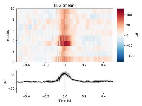Overview Of Artifact Detection — Mne 1 1 1 Documentation