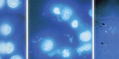 Mycoplasma Dapi