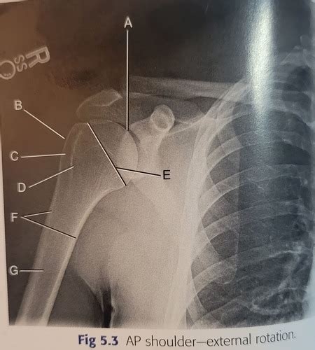 Humerous Diagram Quizlet