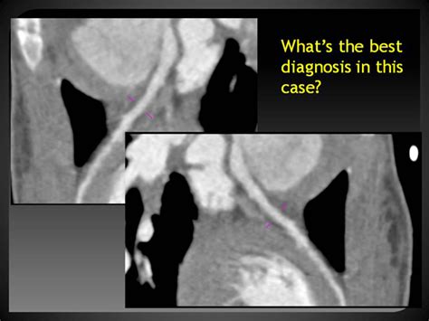 Cardiac Learning Modules Ct Scanning