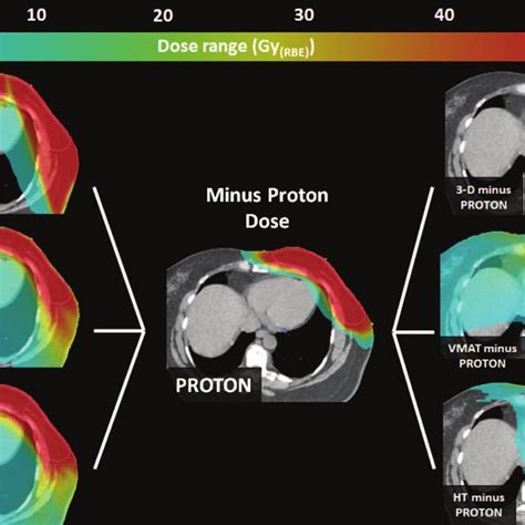 Radiation Therapy Workflow Ct Imaging Provides The 3d Image Set Of The Download Scientific