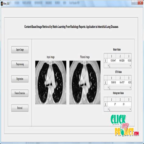 Content Based Image Retrieval By Metric Learning From Radiology Reports