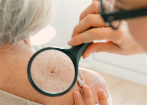 Hautklinik Bad Ragaz Dermatologie Dermis Hautklinik