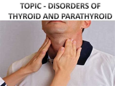 Thyroidswellingetiologypathogenesispptx