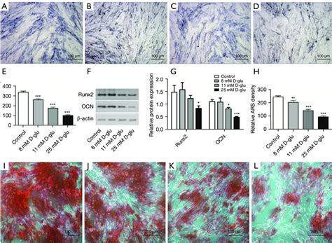 The Osteogenic Differentiation Abilities Of Pdlscs Cultured In Download Scientific Diagram