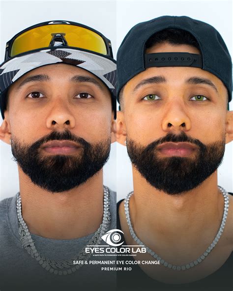 Before After Gallery Eyes Color Lab