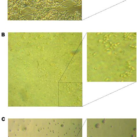 Inverted Microscope Images Show Sessile Cell Organization Of Strain Download Scientific