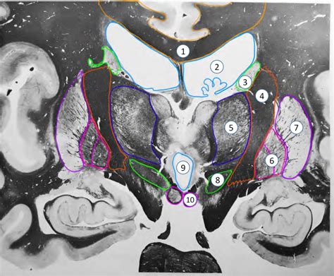 Diencephalon Fig 67 Diagram Quizlet