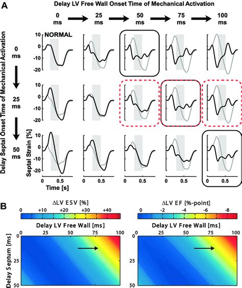 Effect Of Ventricular Dyssynchrony On The Septal Deformation Pattern
