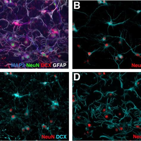 Pdf Ctip2 Satb2 Prox1 And Gad65 Expressing Neurons In Rat