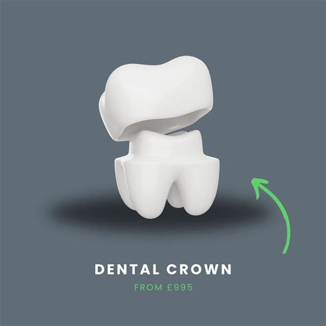Dental Crown Cost Uk From £23 Pm All Types