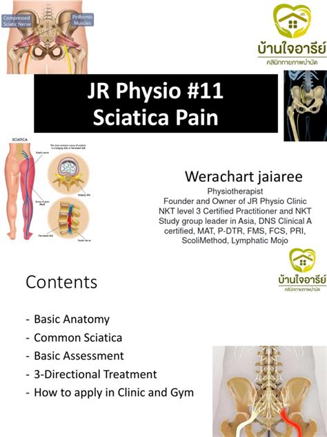 Jr Physio11 Sciatica Pdf Human Leg Neuroanatomy