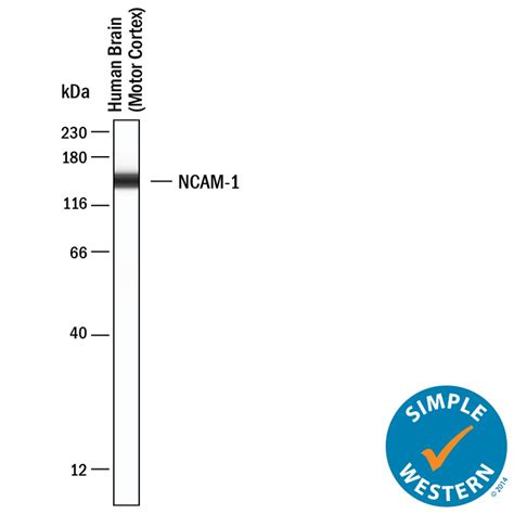 Human Ncam 1cd56 Antibody Mab24082 100 Randd Systems