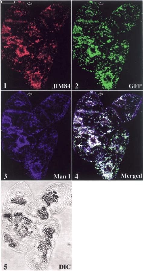 Colocalization Of Three Different Golgi Markers In Transgenic By 2 Download Scientific Diagram