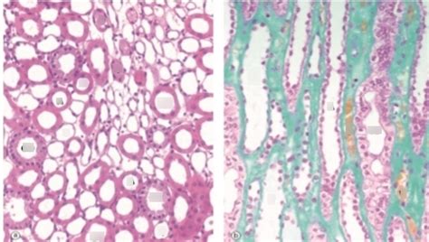 Loop Of Henle Diagram Quizlet