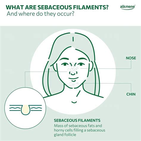 What Are Sebaceous Filaments And How To Get Rid Of Them Alkmene