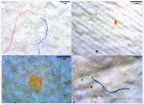 Microscopic Images Showing Different Morphotypes And Color Of