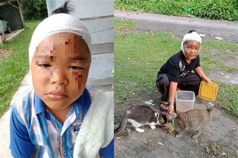 Kepala Berbalut Muka Calar Balar Budak Lelaki Ini Sempat Lagi Minta