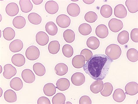 Wright Stain Epredia