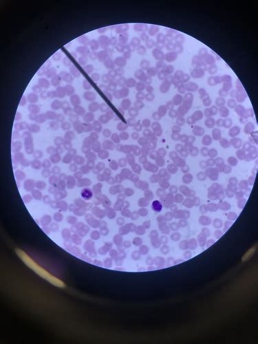 Slides Protists Flashcards Quizlet