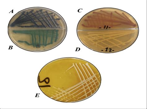 Bacterial Isolates On Uti Chromagar Ae Serohgenes Appear Dark Blue On