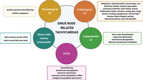Sinus Tachycardia A Multidisciplinary Expert Focused Review