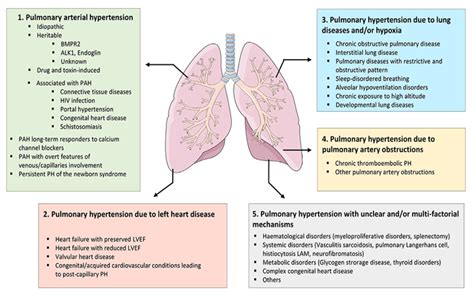 Pathogenesis Of Pulmonary Hypertension Download Scientific Diagram
