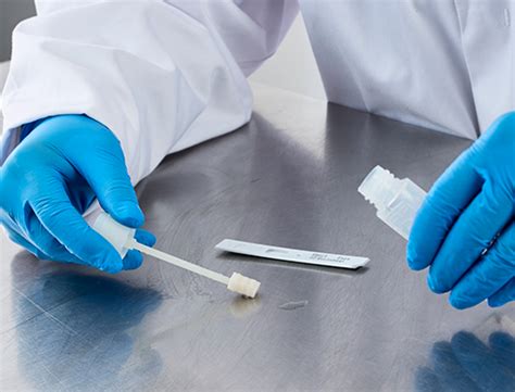 Allergen Testing Klipspringer