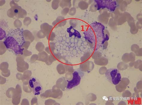 看图识细胞（第71期）形态学