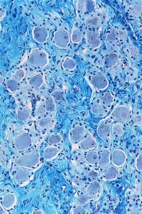 Nerve Ganglion Light Micrograph Stock Image C0160532 Science