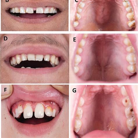 Amino Acid Sequence And Mutations Of Lrp5 And Lrp6 Download Scientific Diagram